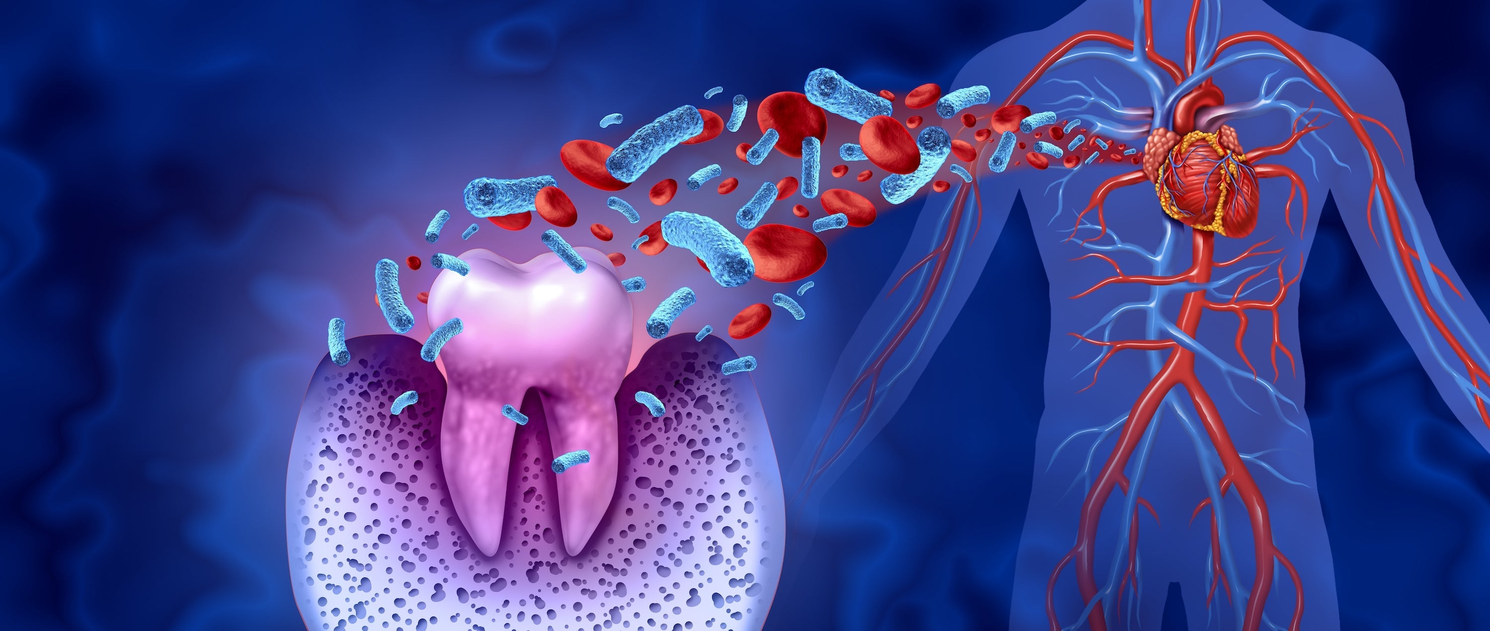 The Ins & Outs of Gingivitis – Ollie